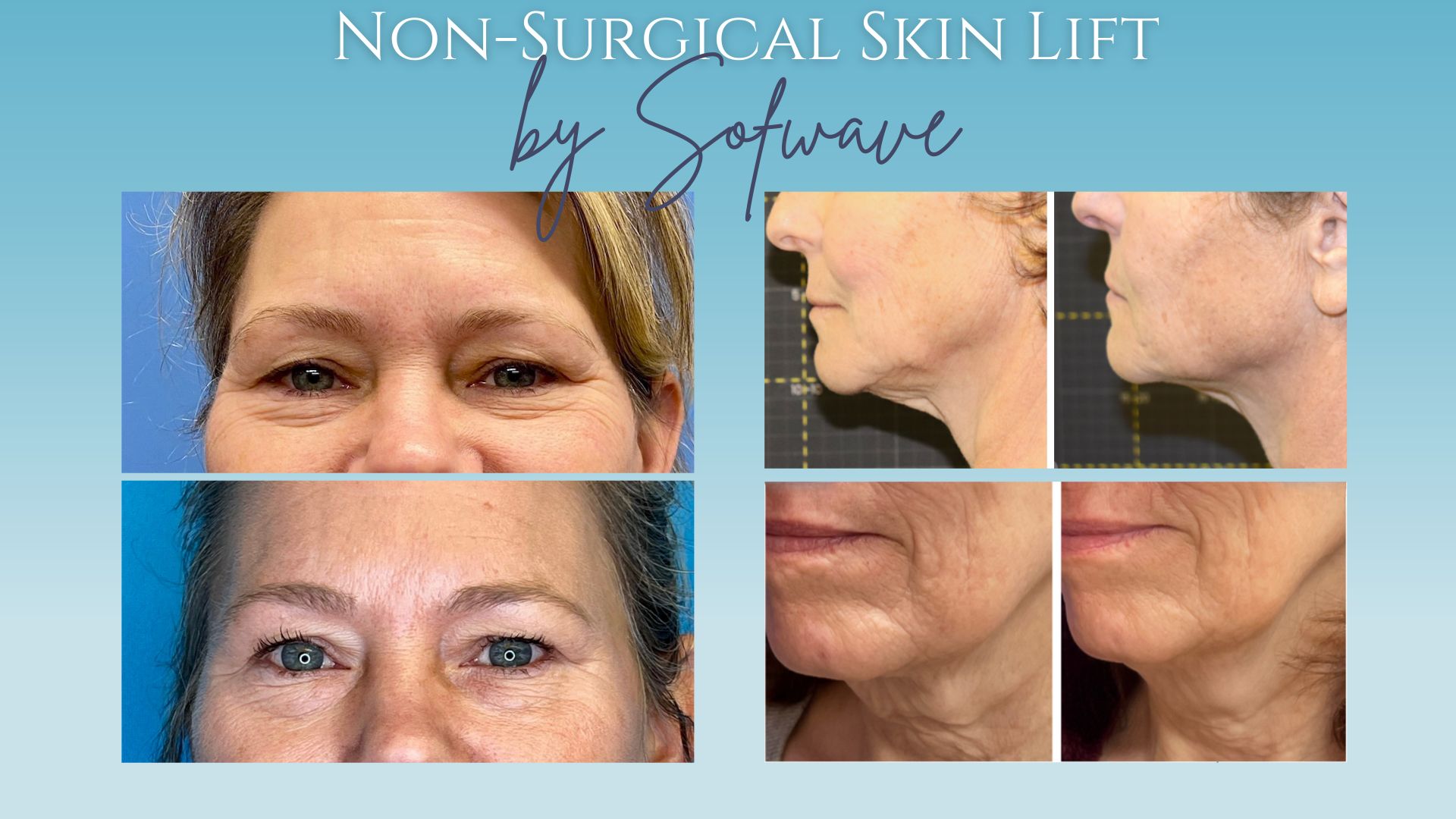 Current Specials & Promotions | Chicago Aesthetics