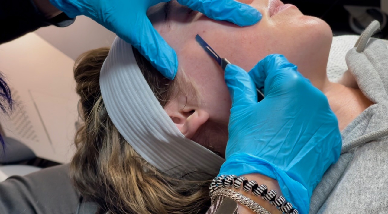 Dermaplaning | Chicago Aesthetic Surgery & Med Spa